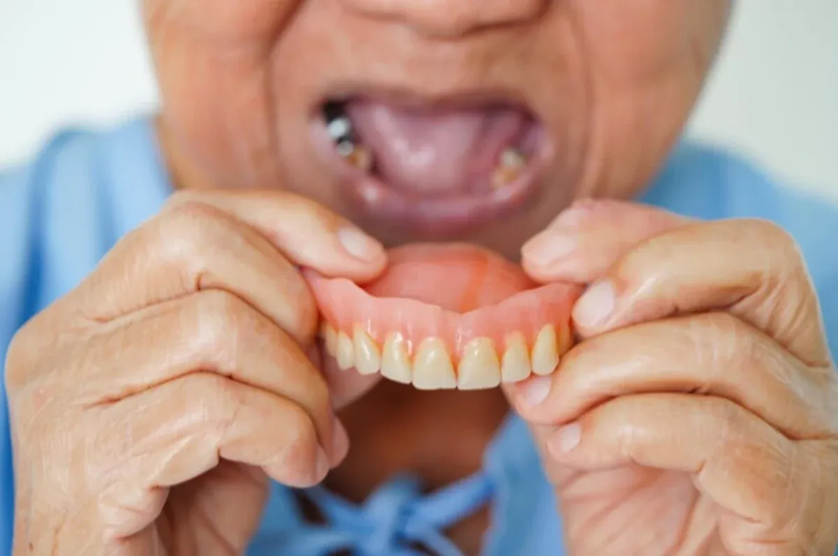 How Implant Dentures Can Transform Your Lifestyle